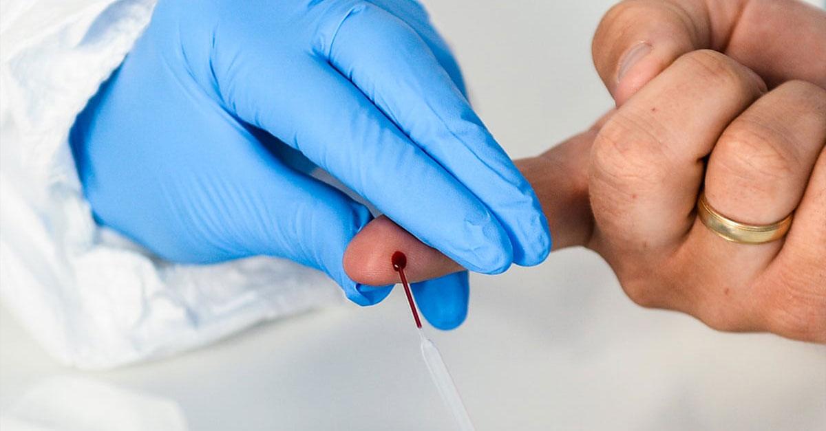 The Fastep® COVID-19 IgG/IgM Rapid Test Device by Assure Tech., distri ...